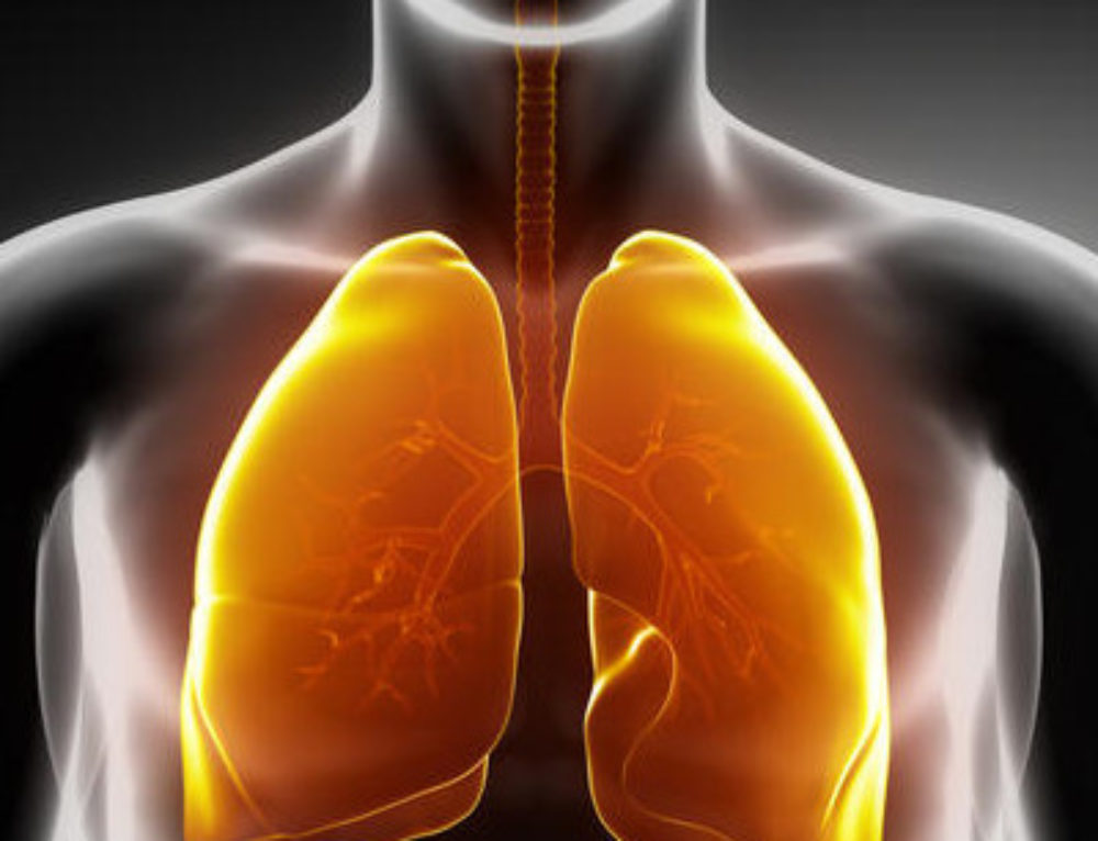X-RAYS of Lungs affected with ARDS - ARDS Global
