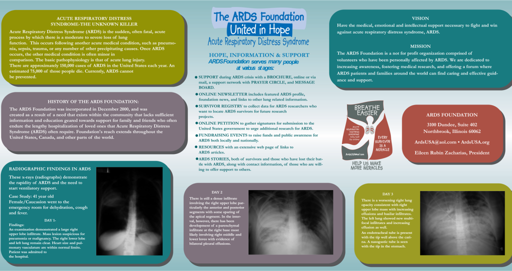 ards poster(radiographic findings) - ARDS Global